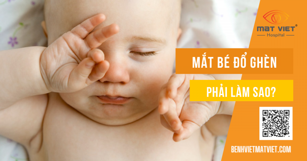 Phải làm gì khi mắt bé bị đổ ghèn?