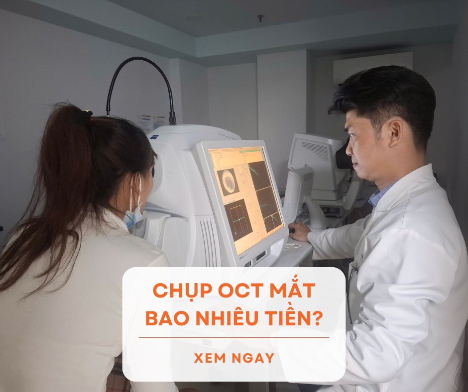 Chụp OCT mắt bao nhiêu tiền? Chụp OCT có đau không? | Bệnh viện mắt VIỆT